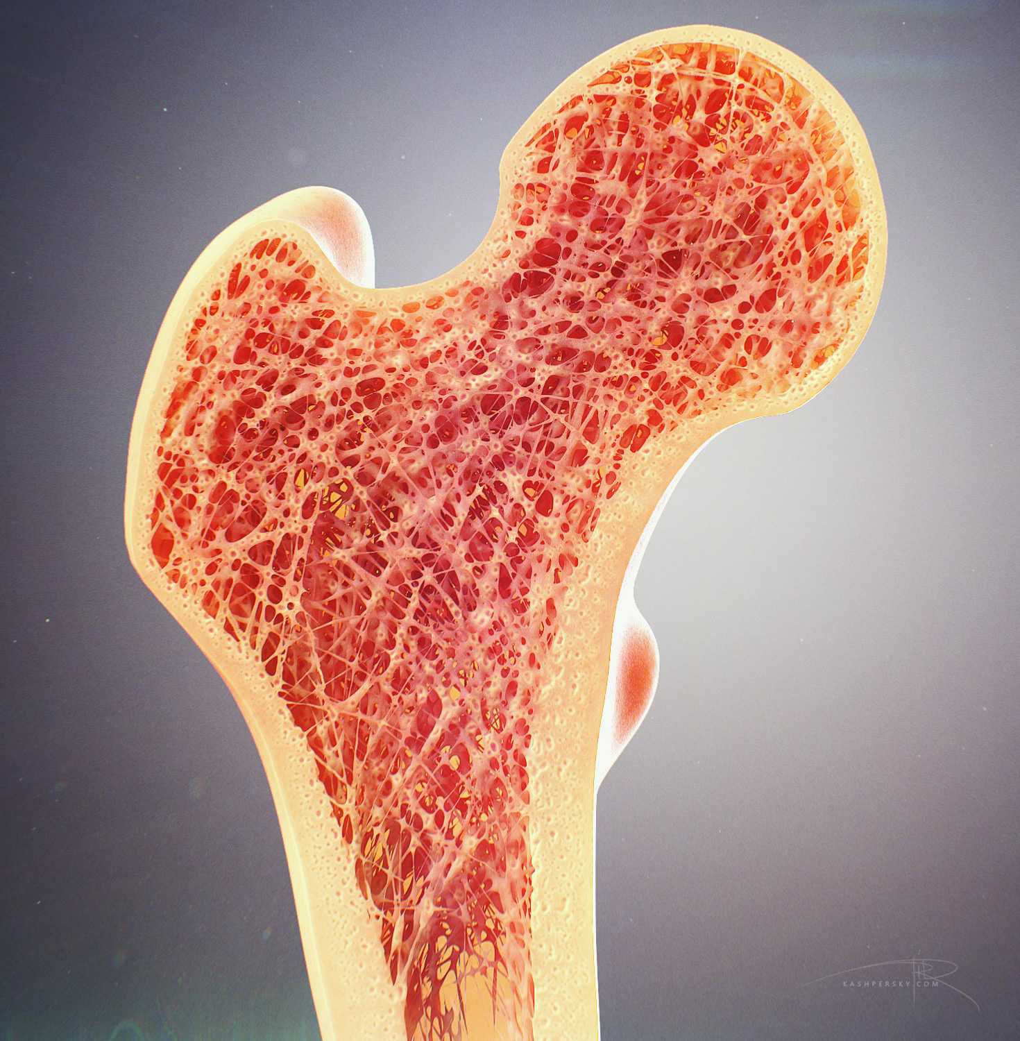 Femur Bone Cross Section - Cross Section View Of A Human Femur Bone ... Femur Bone Cross Section - Cross Section View Of A Human Femur Bone ...
