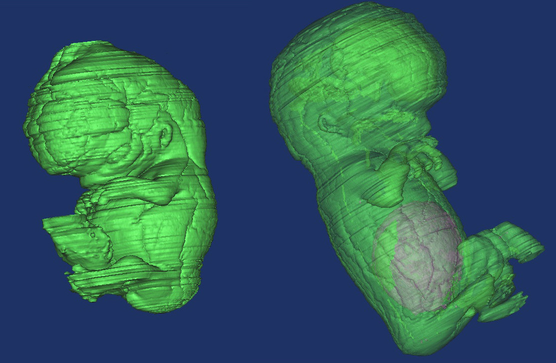 Encephalo Creative Studios - Human Embryology